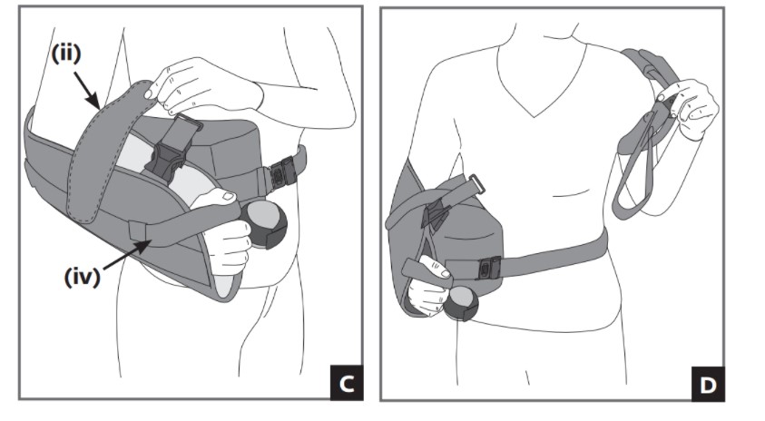 Attelle d'épaule Ultrasling PRO - Donjoy